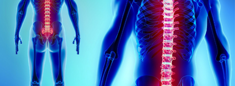 Anatomia da Coluna Vertebral - Dr. William Zarza