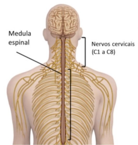 Cervicobraquialgia: Causas, Sintomas e Tratamentos - Dr. William Zarza