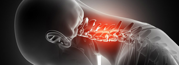 Fraturas da Coluna Vertebral - Dr. William Zarza